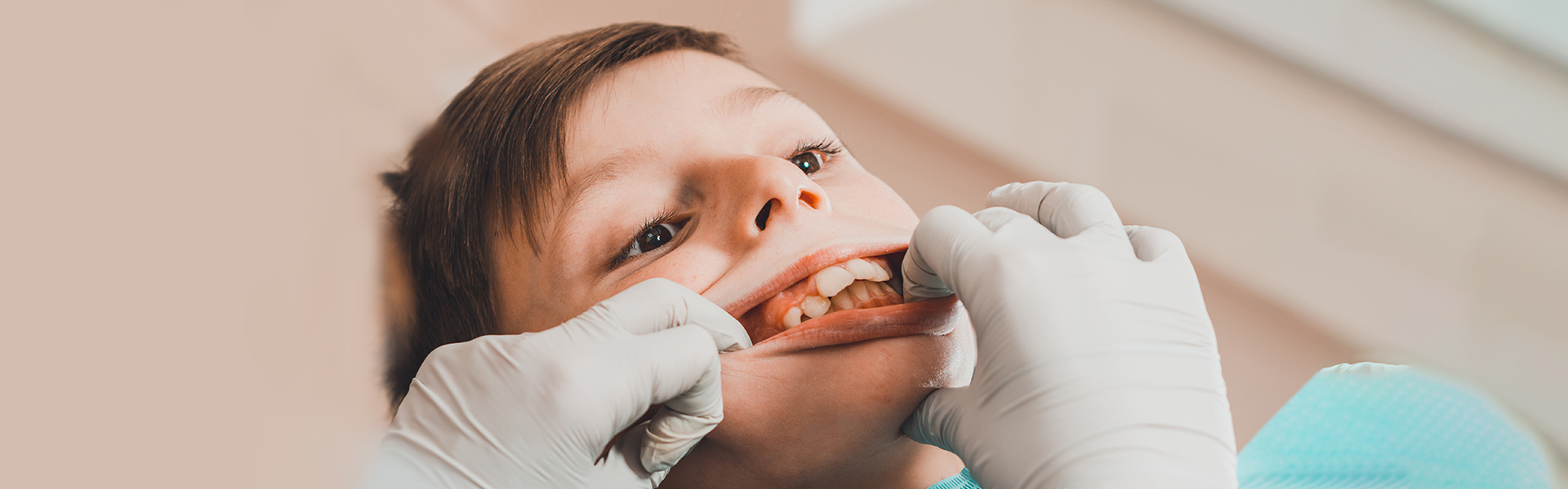 Teeth Crowding Treatment: Fixing Overlapping Teeth | Blog